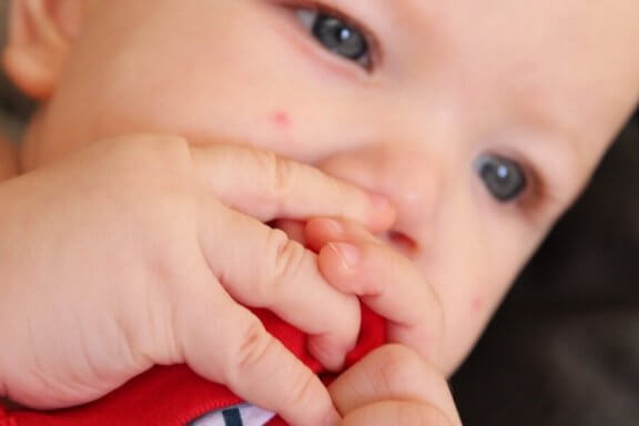 Milia in Newborns: Causes, Symptoms and Treatment - You are Mom